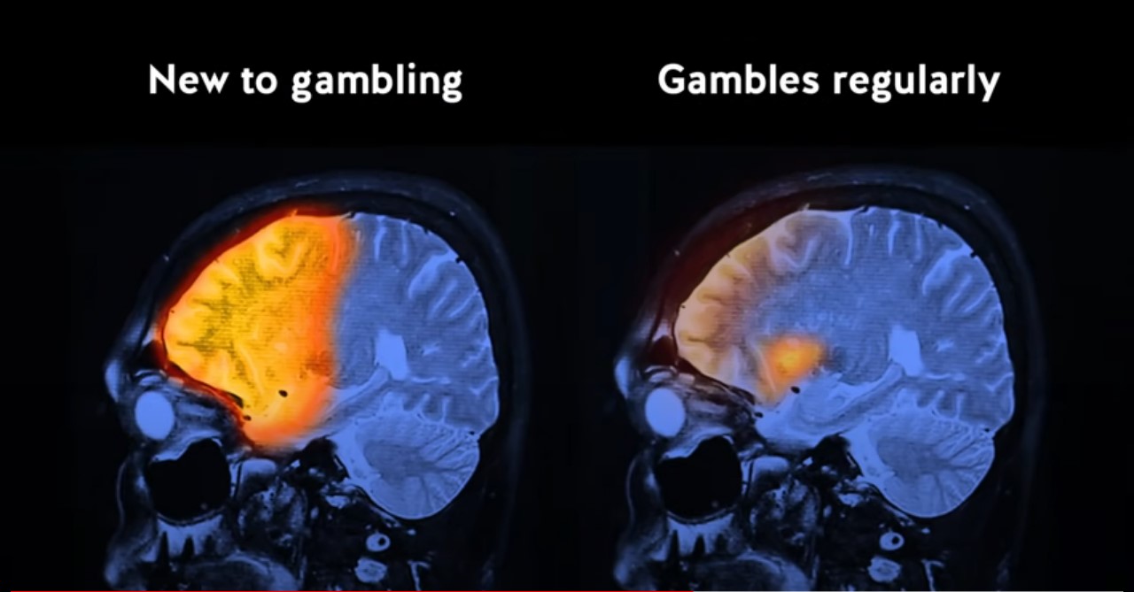 Module 3 - Gambling and the Physical Response - Anglicare